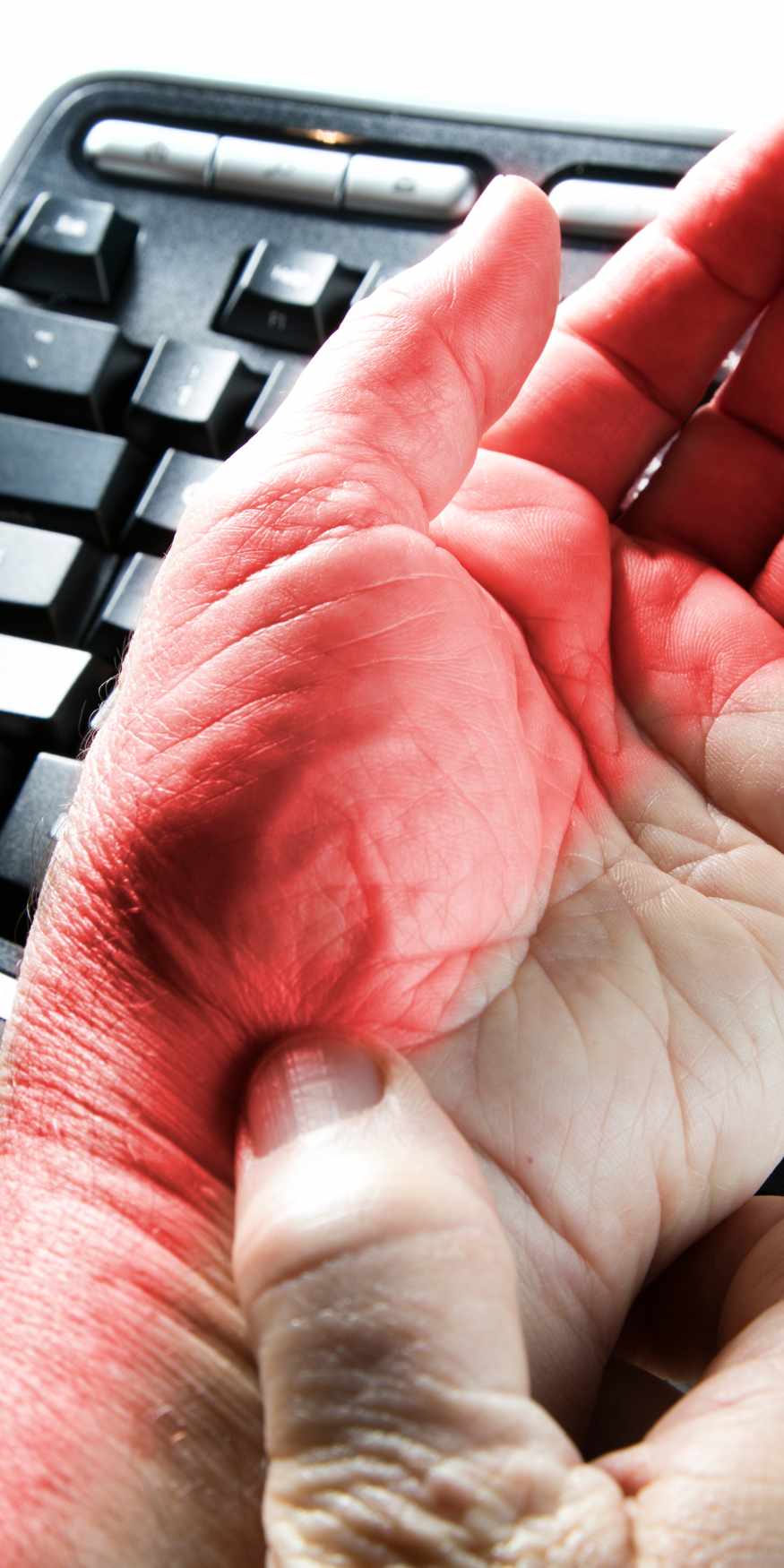 Carpaal Tunnel Syndroom Capelle - Fysio Connected Capelle